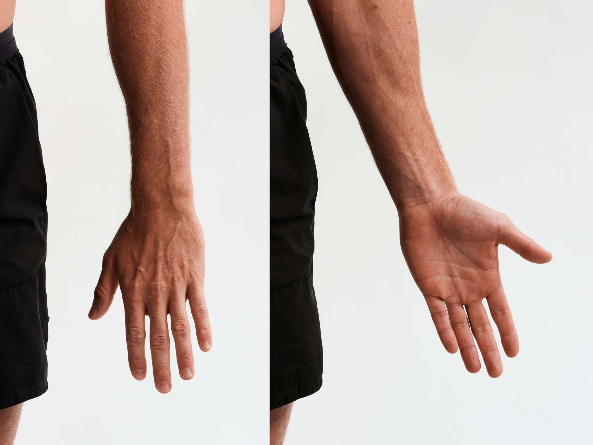 Handled - Idrottskadespecialisterna.se